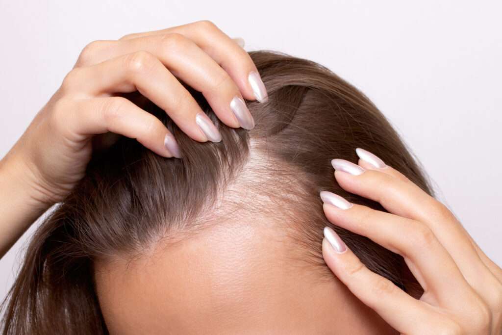 Rooted in Health: The Impact of Gut Health on Female Hair Loss and ...